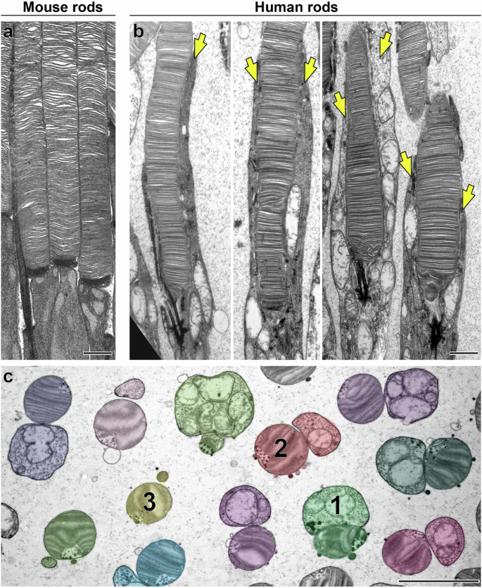 Unique ultrastructural organization of human rod photoreceptors ...