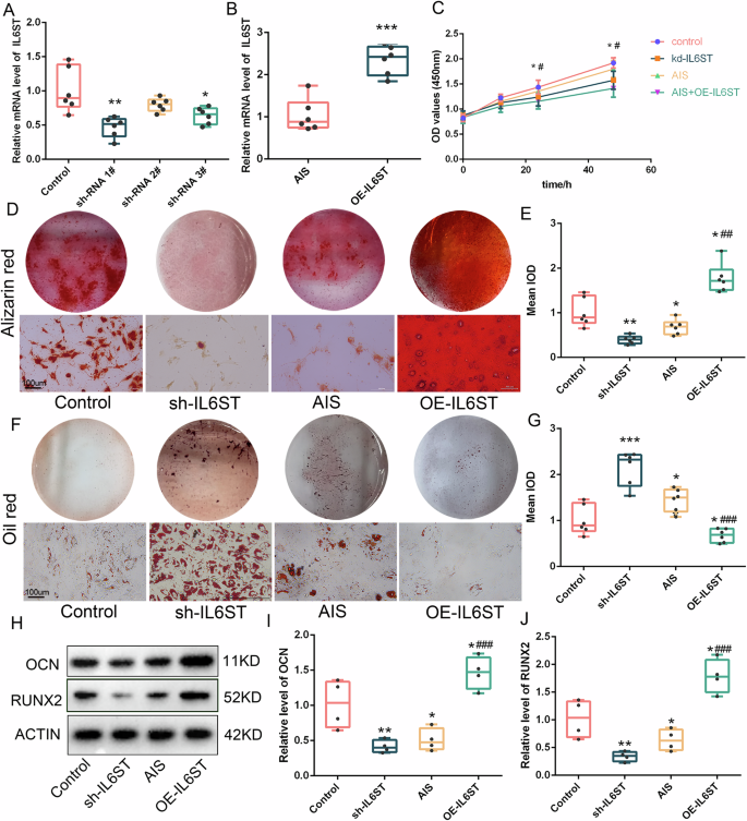IL6ST participates in the development of adolescent idiopathic ...