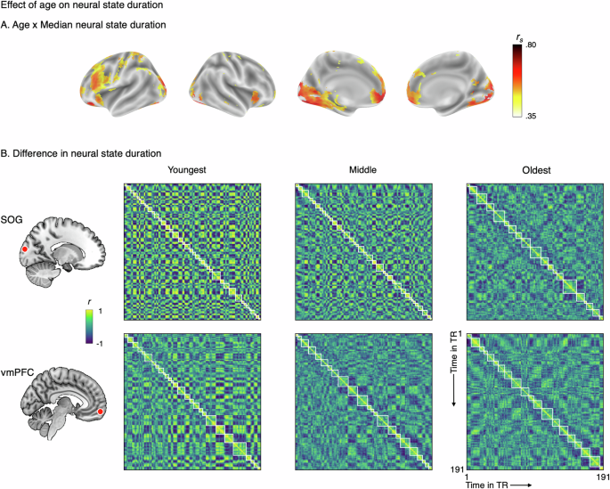 Temporal dedifferentiation of neural states with age during ...
