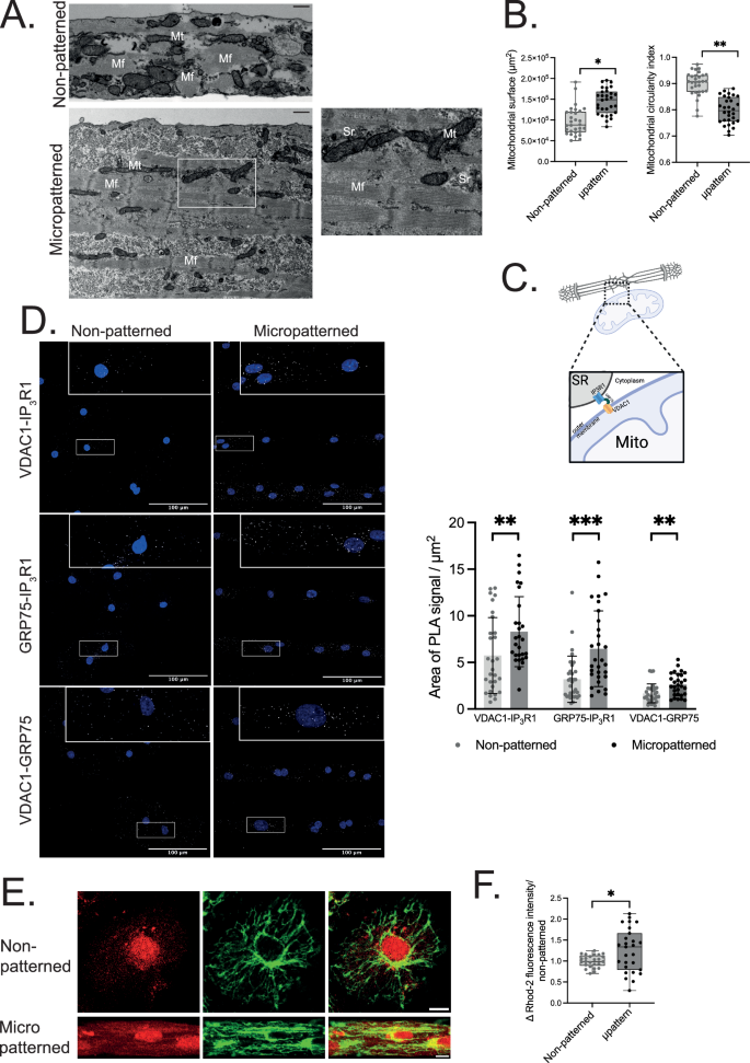 Myocardial disarray drives metabolic inefficiency in human ...