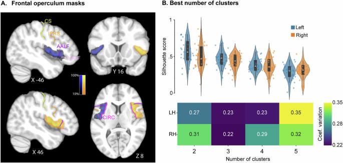 The prefrontal operculum, a human-specific hub for the cognitive ...