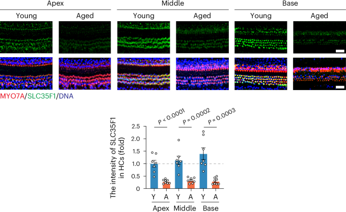 Molecular marker of cochlear aging and hearing loss in primates ...
