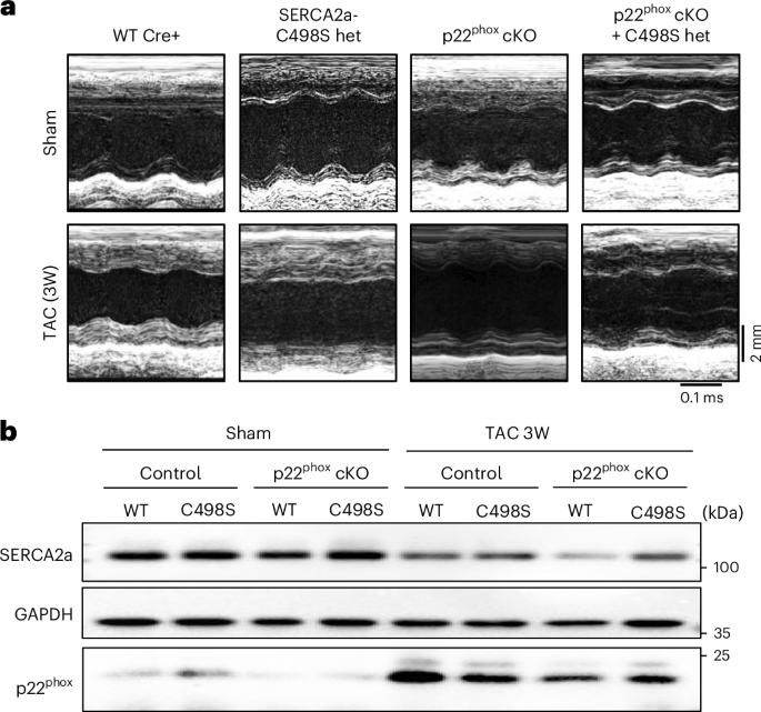 Oxidase subunit unexpectedly prevents oxidation of calcium pump and ...