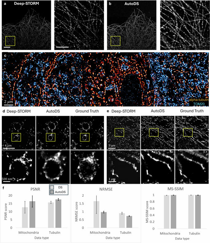 One-click reconstruction in single-molecule localization microscopy via experimental parameter ...