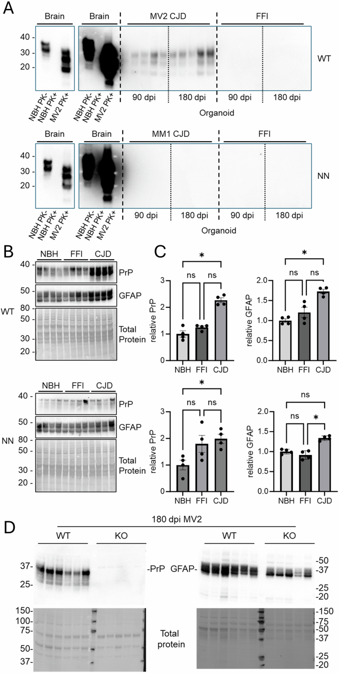 Infecting human brain organoids with FFI or sCJD preserves prion traits ...