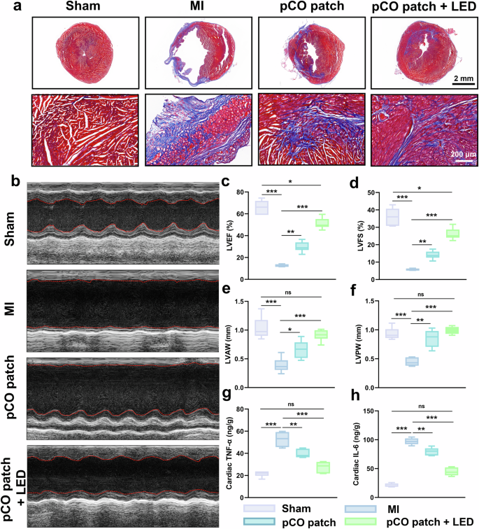 Photoactivable CO-releasing hydrogel based cardiac patch with a self ...