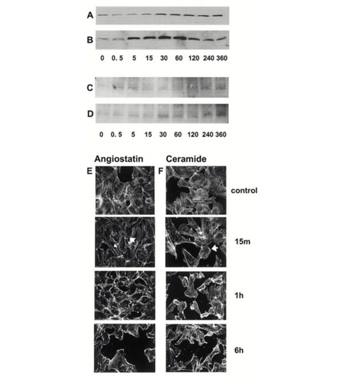 Angiostatin effects on endothelial cells mediated by ceramide and RhoA ...