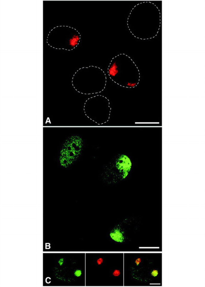 Local UV‐induced DNA damage in cell nuclei results in local ...
