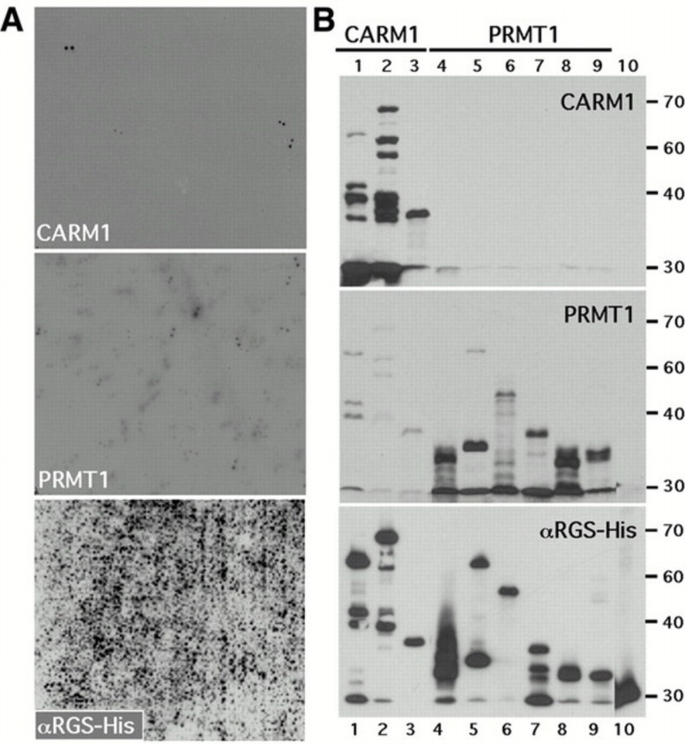 PABP1 identified as an arginine methyltransferase substrate using high ...