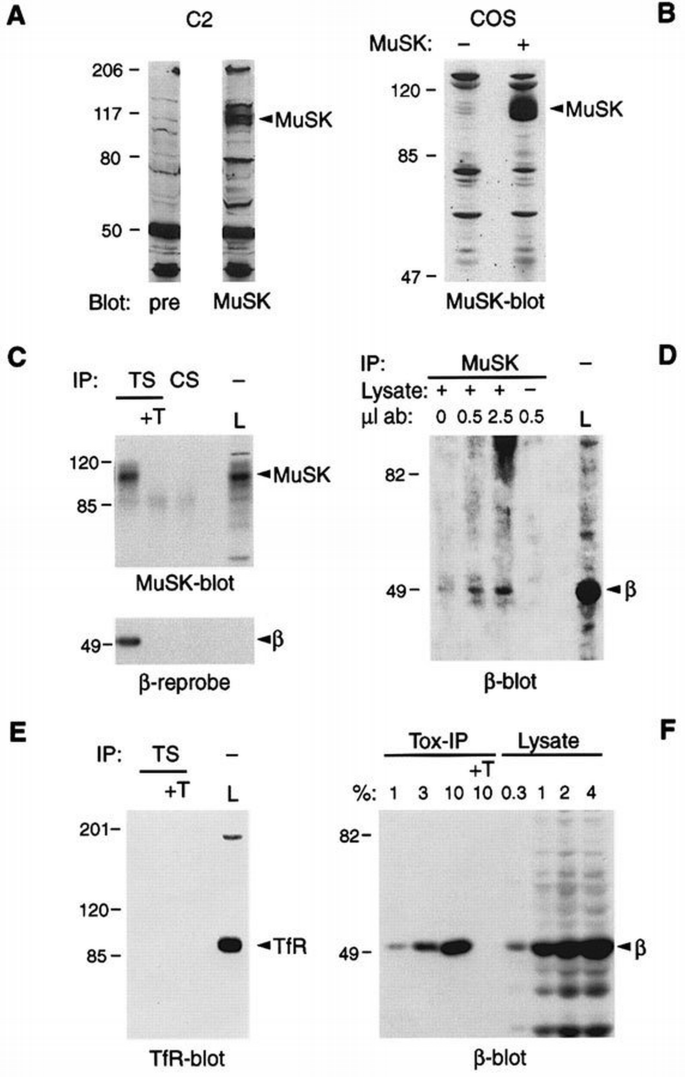 Association of muscle‐specific kinase MuSK with the acetylcholine ...