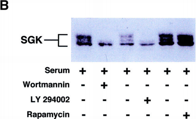 Serum and glucocorticoid‐inducible kinase (SGK) is a target of the PI 3 ...