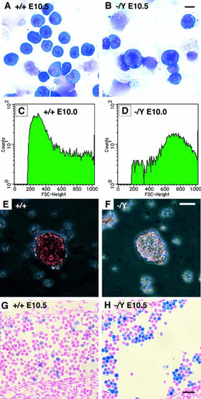 Heme deficiency in erythroid lineage causes differentiation arrest and ...