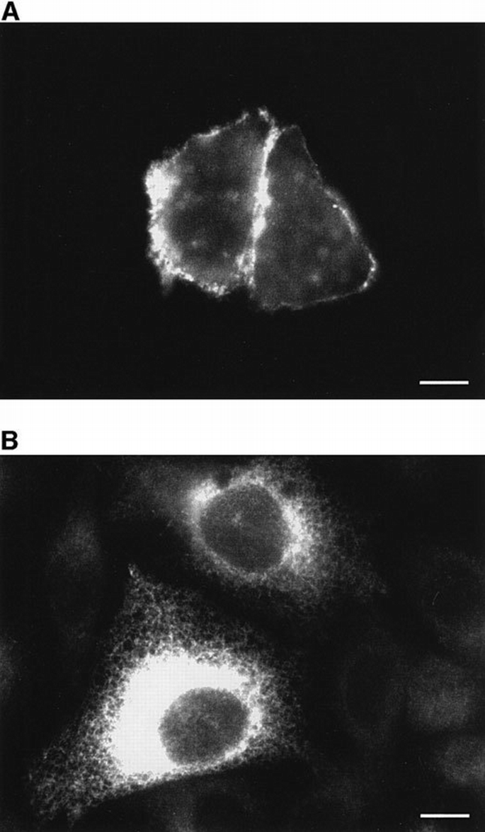 Effects of PMCA and SERCA pump overexpression on the kinetics of cell ...