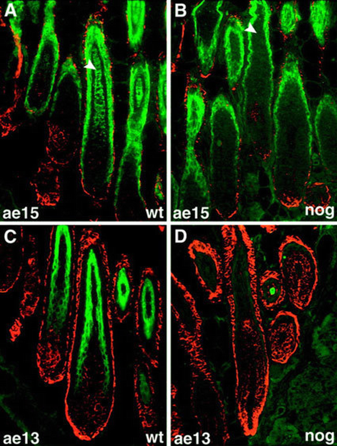 Inhibition of Bmp signaling affects growth and differentiation in the ...