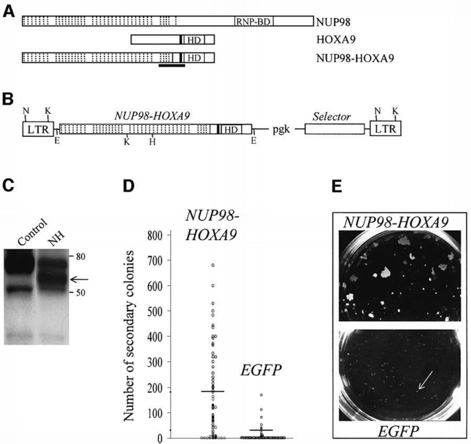 NUP98–HOXA9 expression in hemopoietic stem cells induces chronic and ...