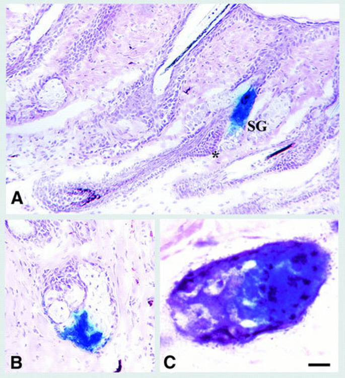 Multiple classes of stem cells in cutaneous epithelium: a lineage ...