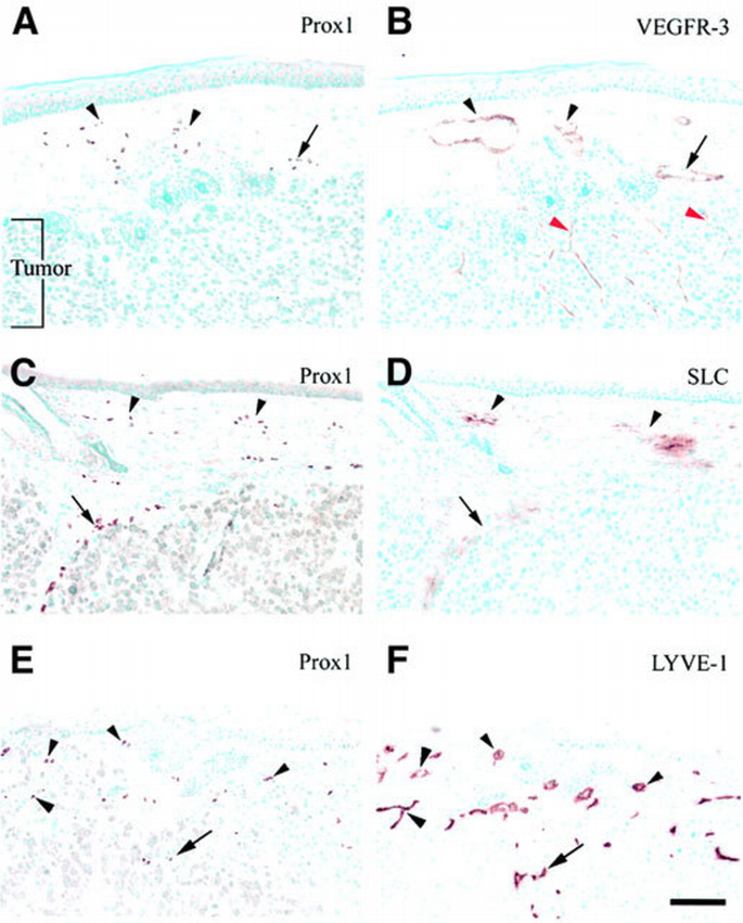 An essential role for Prox1 in the induction of the lymphatic ...
