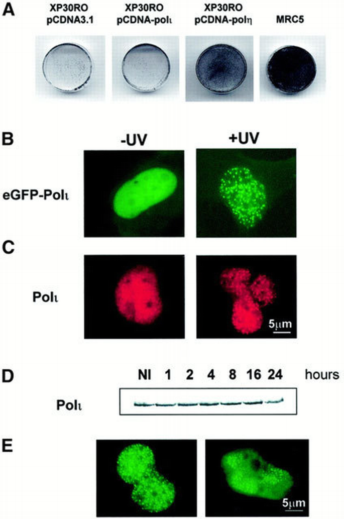 Localization of DNA polymerases η and ι to the replication machinery is ...