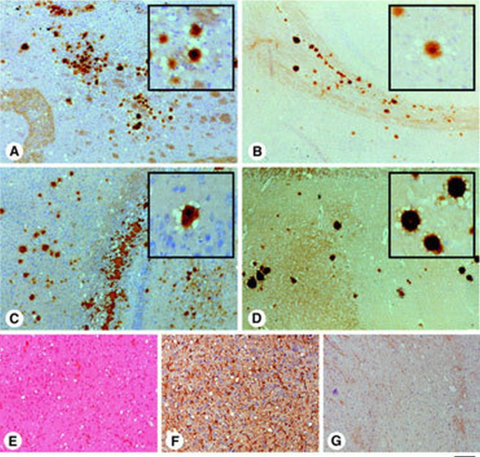 BSE prions propagate as either variant CJD‐like or sporadic CJD‐like ...