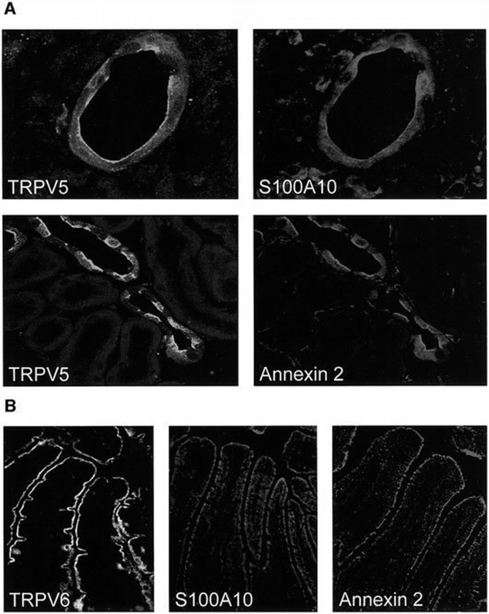Functional expression of the epithelial Ca2+ channels (TRPV5 and TRPV6 ...