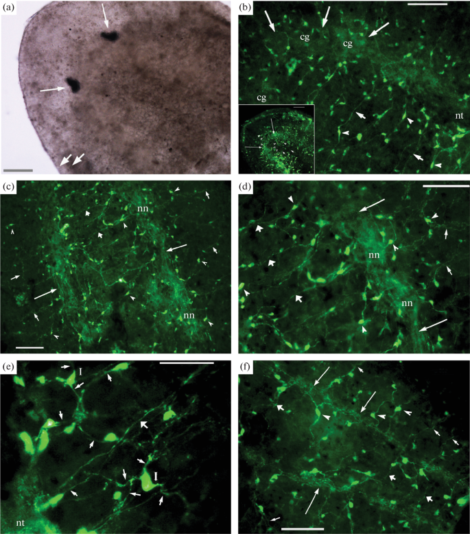Morphometric Analysis of Serotoninergic Structures in the Nervous ...