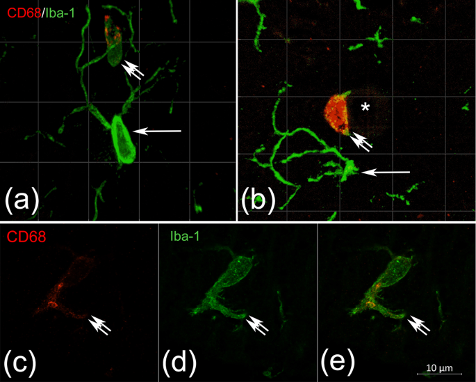 Microglia Immunophenotyping in Paraffin Sections of the Brain | Cell ...