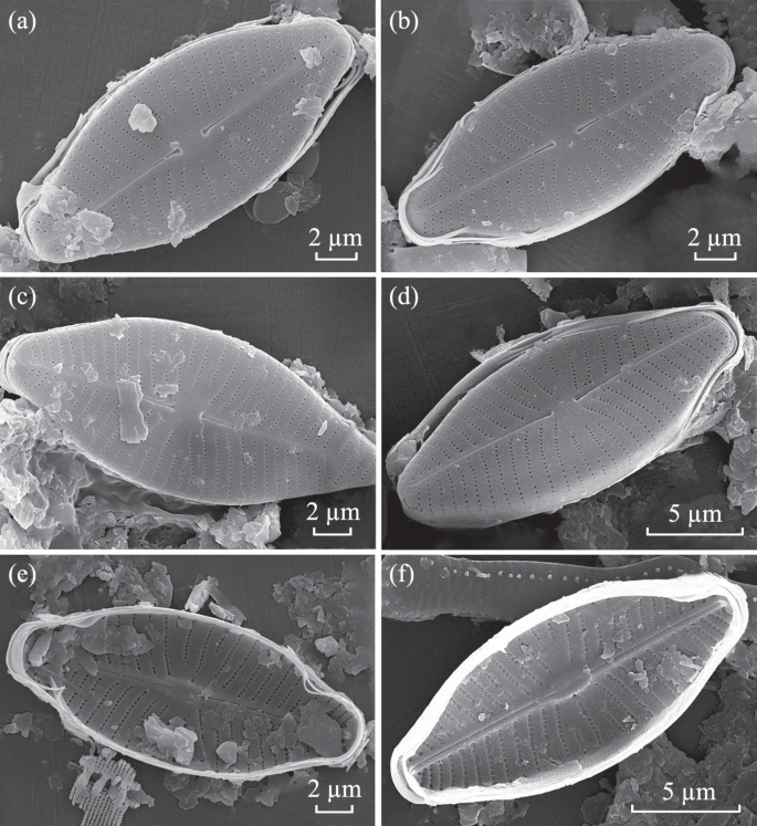 Witkowskia makarovae sp. nov. (Bacillariophyta) from a Nameless Lake in ...