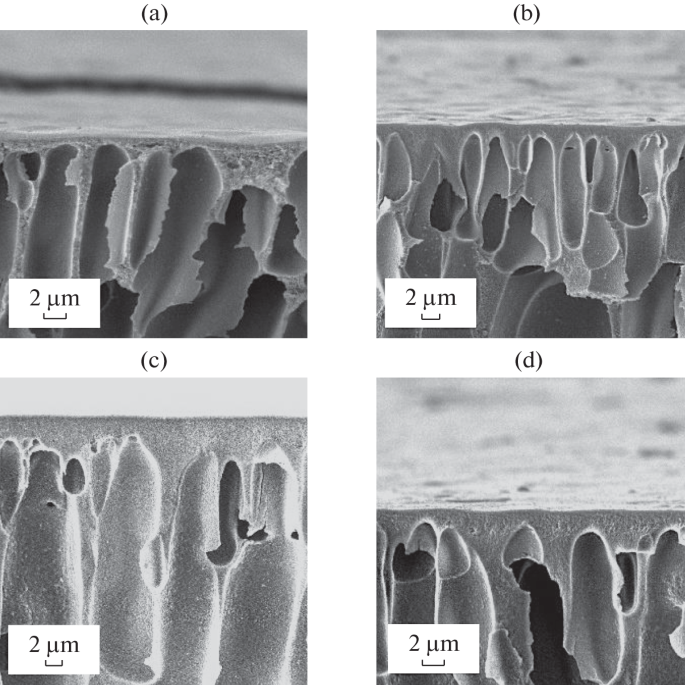 Modification of Ultrafiltration Membranes Based on Polyacrylonitrile ...