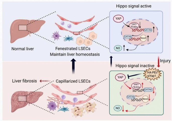 YAP contributes to liver injury through mediating capillarization of ...