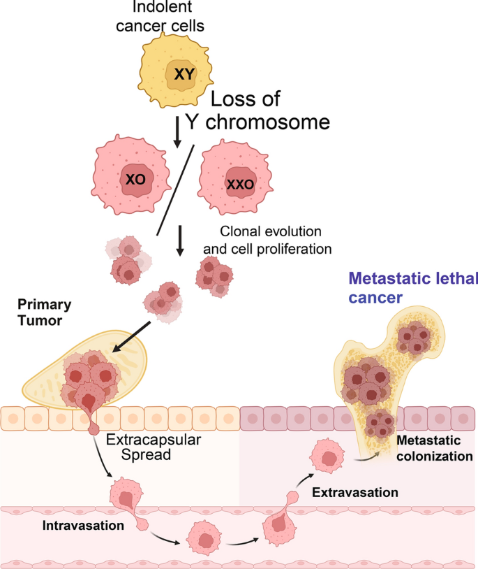 Y-chromosome alteration and its impact on cancer progression and ...