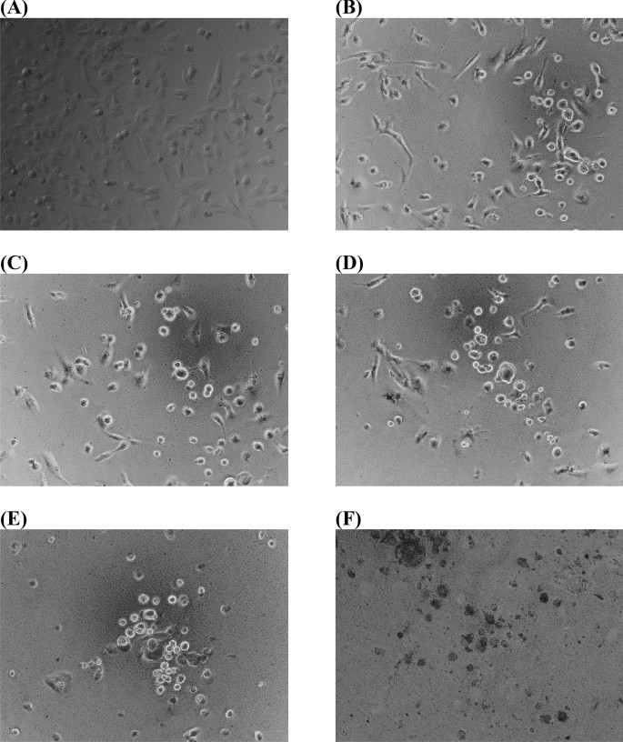 Doxorubicin delivery of green-synthesized gold nanoparticles to MDA-MB ...