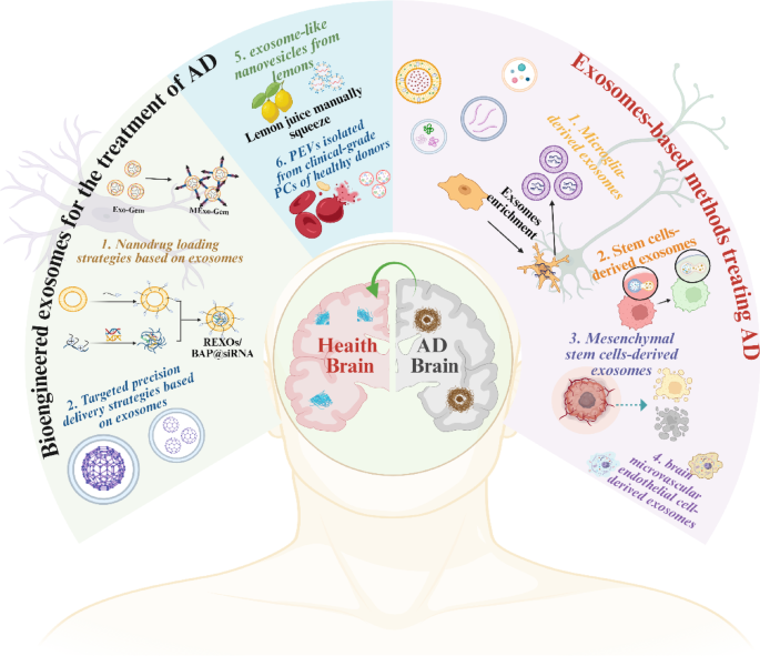 Research progress of exosomes used in the Alzheimer's disease treatment ...