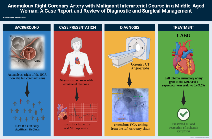 Anomalous right coronary artery stemming from left coronary sinus and ...