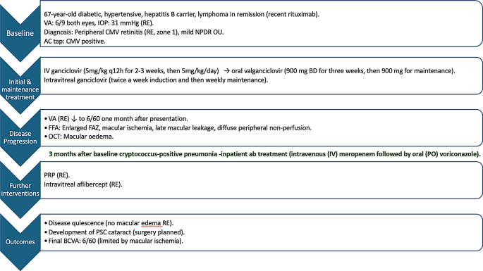 Cytomegalovirus retinitis (CMVR) in an HIV-negative patient with a ...