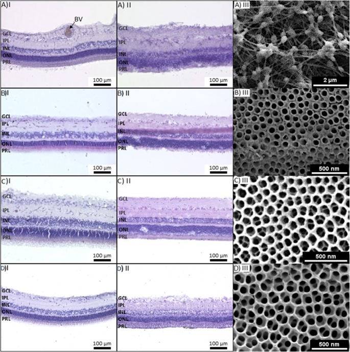 Organotypic Culture of Adult Vascularized Porcine Retina Explants In ...
