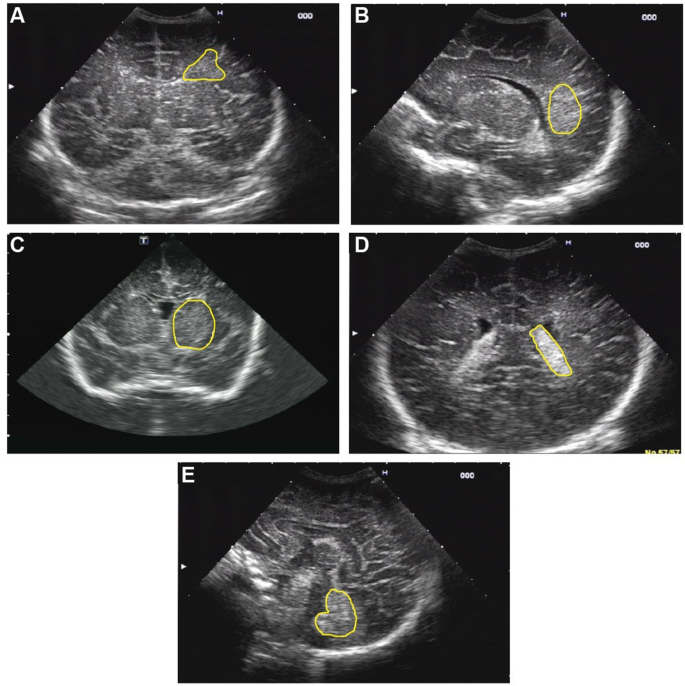 Application of snake model imaging selection and analysis to the ...