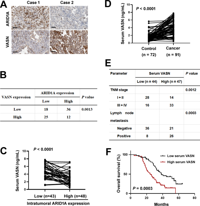 VASN promotes the aggressive phenotype in ARID1A-deficient lung ...