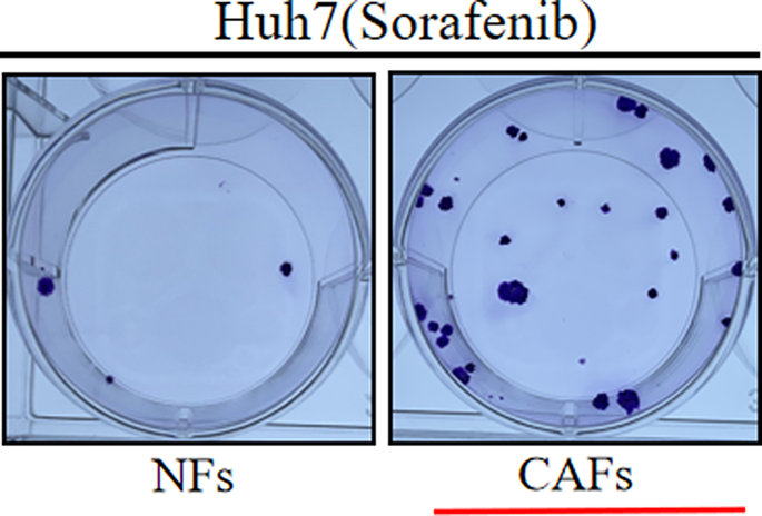 Correction: Cancer-associated fibroblasts induce sorafenib resistance ...