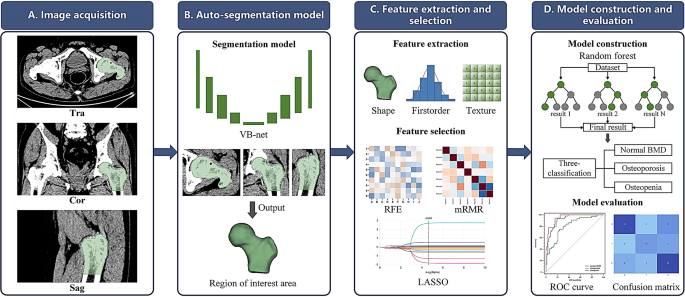 Automated opportunistic screening for osteoporosis using deep learning-based automatic ...