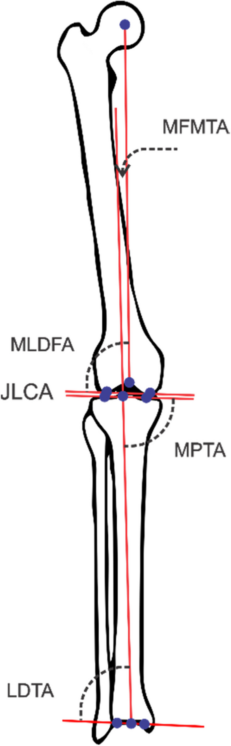 Automatic assessment of lower limb deformities using high-resolution X ...