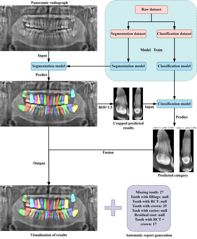 A dual-labeled dataset and fusion model for automatic teeth segmentation, numbering, and state ...