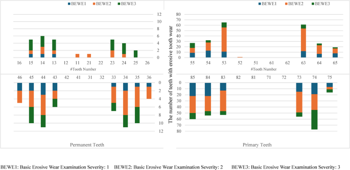 Prevalence and associated factors of erosive tooth wear in Turkish ...