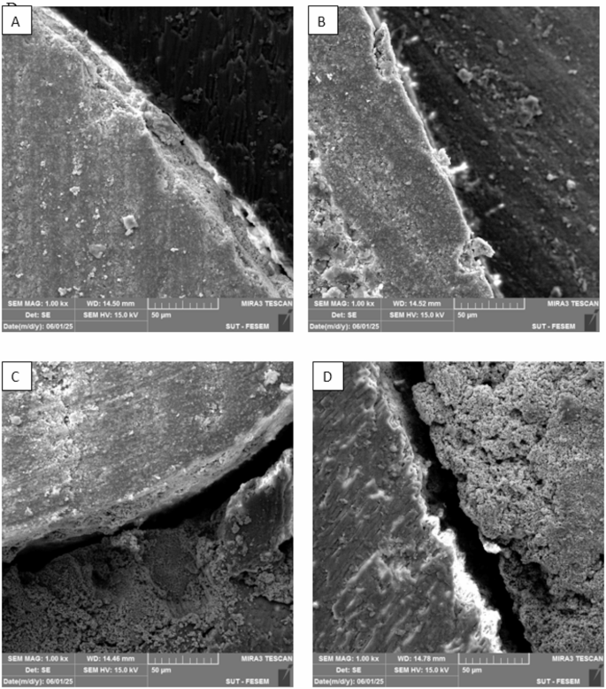 Effect of diode laser irradiation on push-out bond strength of fiber ...