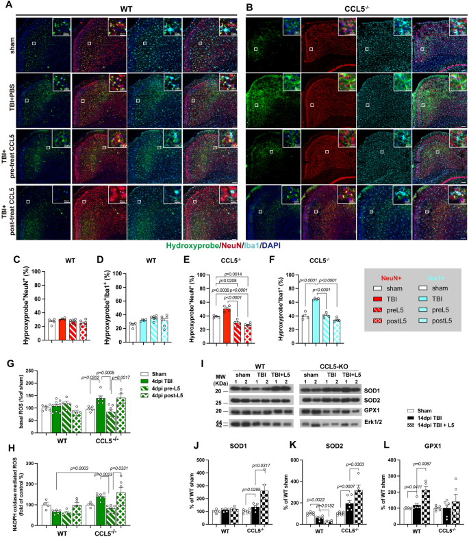 CCL5/RANTES signaling in inflammation dysregulation after mild ...