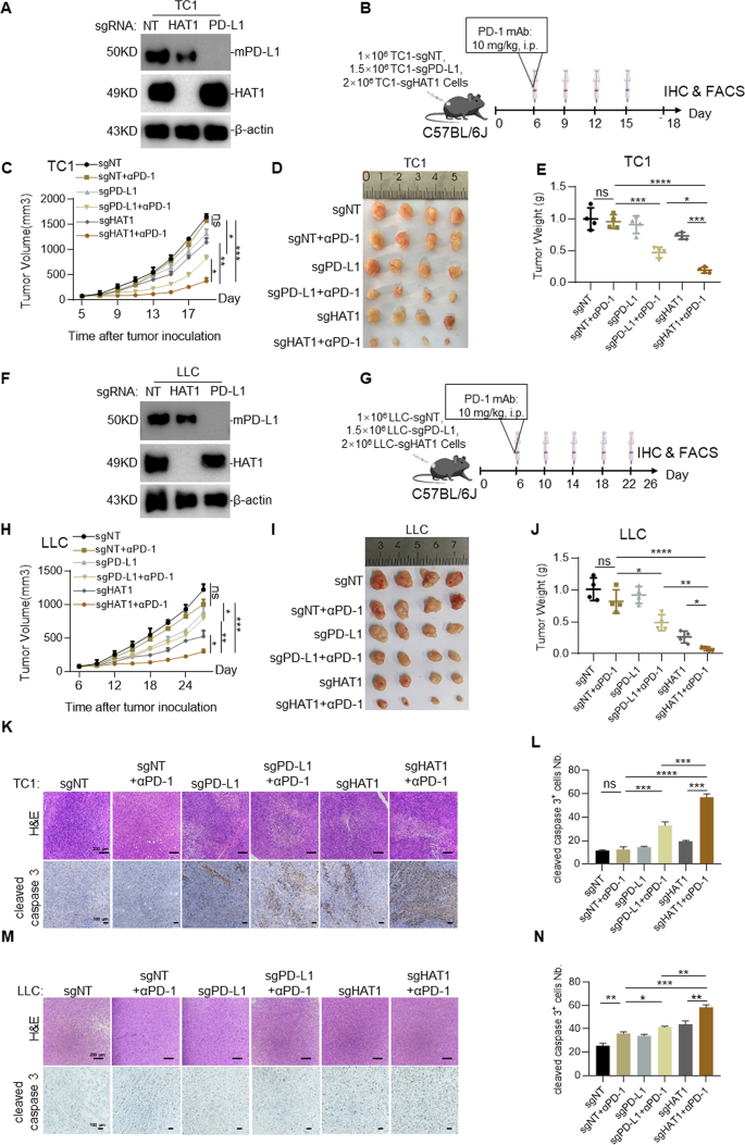 WNT pathway inhibition sensitizes HAT1-high lung cancers to treatment ...