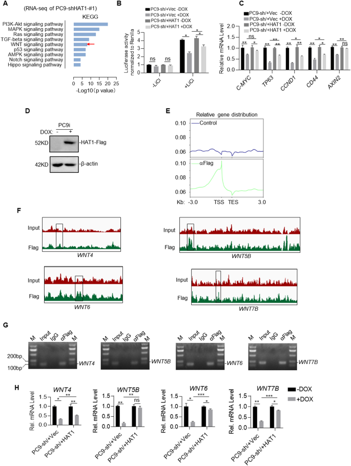 WNT pathway inhibition sensitizes HAT1-high lung cancers to treatment ...