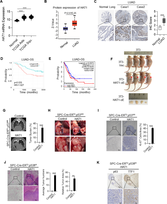 WNT pathway inhibition sensitizes HAT1-high lung cancers to treatment ...