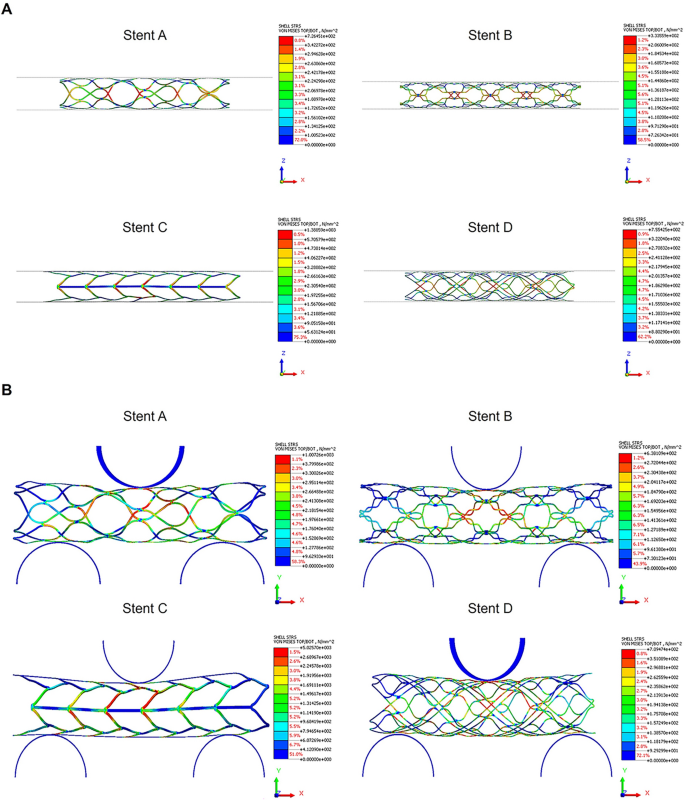 Optimizing stent retrievers for mechanical enhancement and in vitro ...