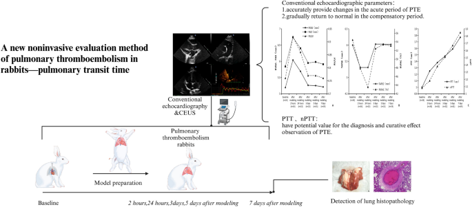 A new noninvasive evaluation method of pulmonary thromboembolism in ...