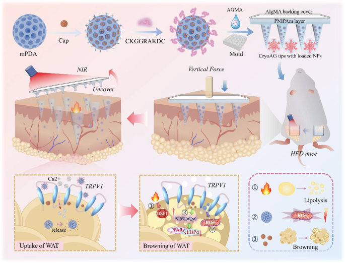 Separable cryo-microneedle patches delivery with capsaicin integrated ...